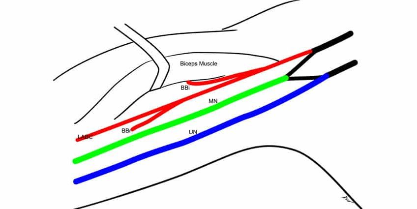 Identifying And Treating Pain From Nerve Tension - Fit at Home